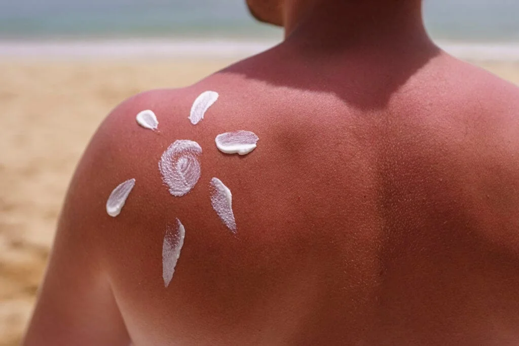 Your Complete Guide to Staying Safe and Healthy in Tenerife: From ...